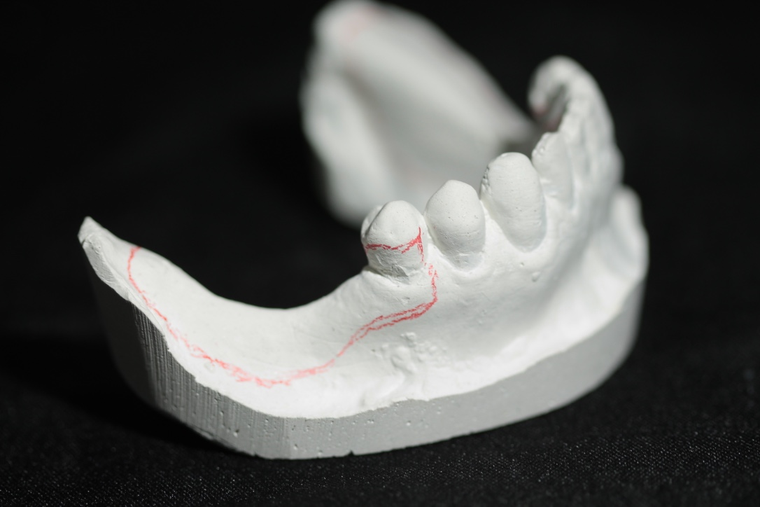 Understanding Design 1 - TCS Dental