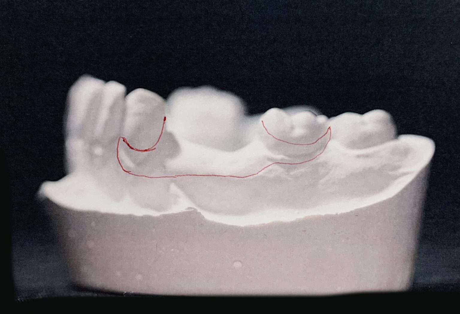 Understanding Design 3 - TCS Dental