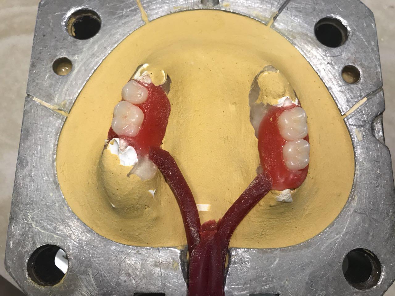 Karadent Double Injection - TCS Dental